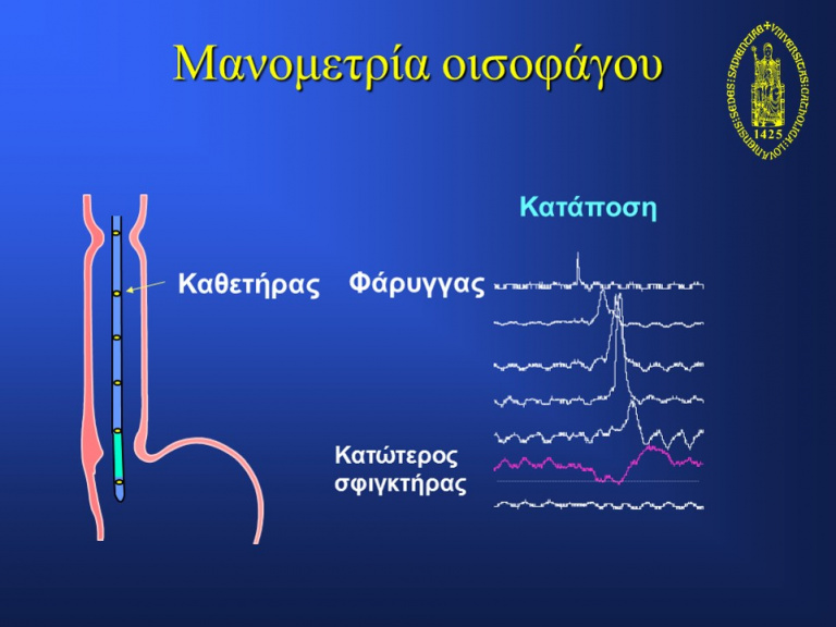 Μανομετρία Οισοφάγου Υψηλής Ανάλυσης (HRM) | Αθανάσιος Παπαθανασόπουλος ...